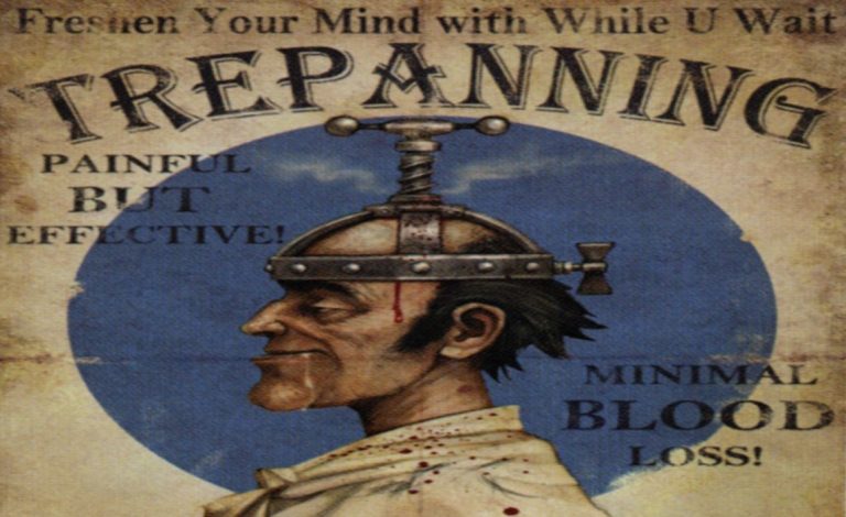 The Bizarre Medical Practice Of Drilling Holes In Your Head - The ...